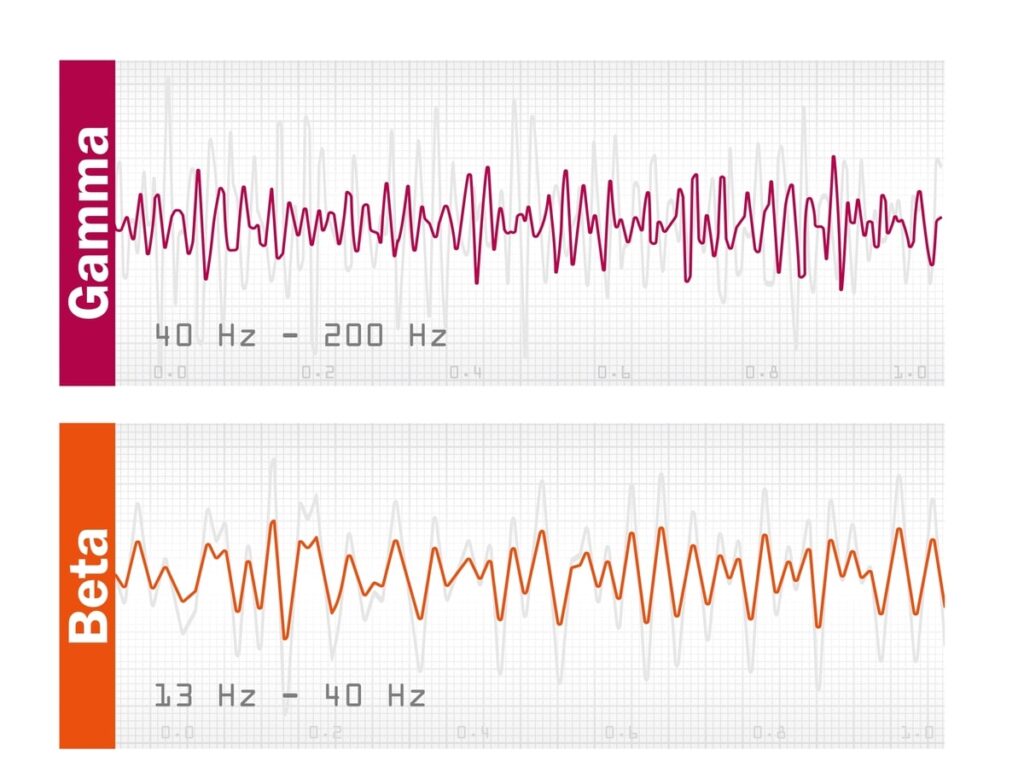 EEG Biofeedback (I stopień) – Centrum Szkoleniowe Fundacji Promyk Słońca